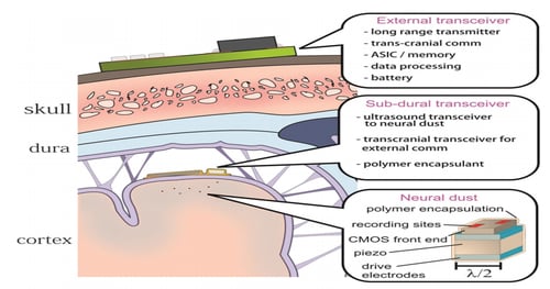 Dust-Sized Brain Devices