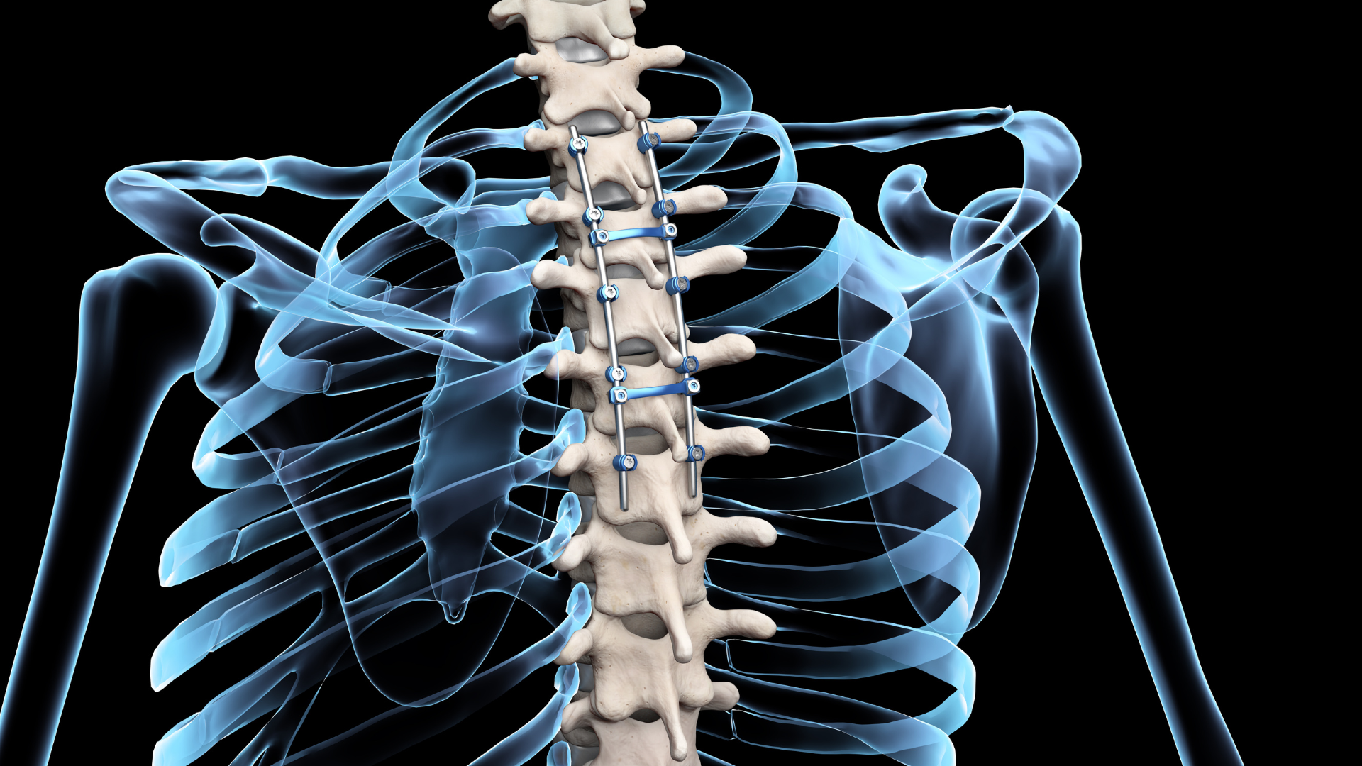 Cardiovascular, Diabetes Segments Lead Medtronic’s Q2