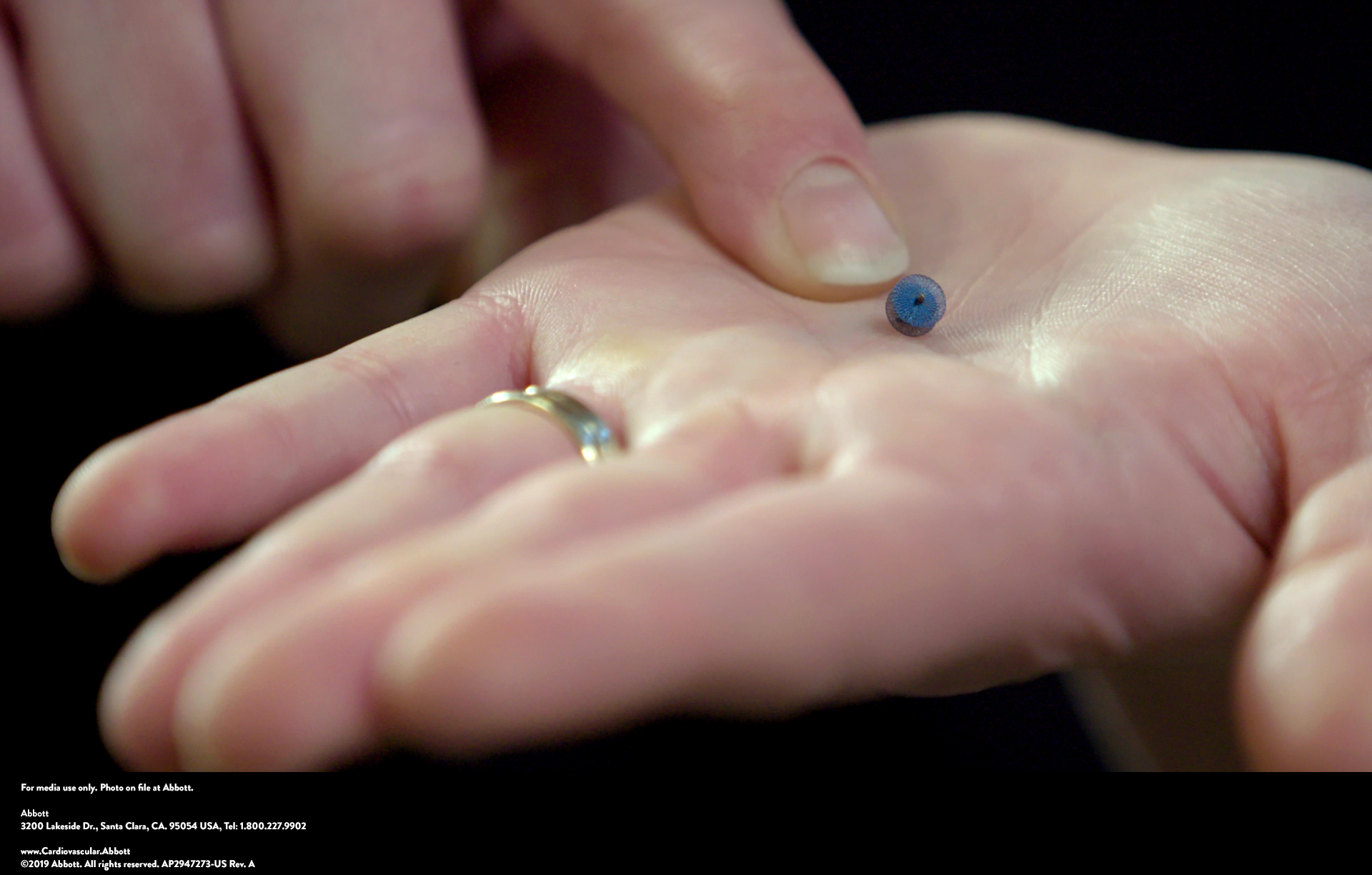 Abbott’s Pediatric Cardiovascular Devices Gain CE Mark