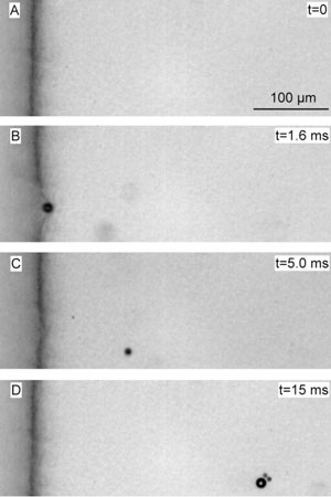 Microphotography Captures Microbubbles Breaking Up Fibrin Clot