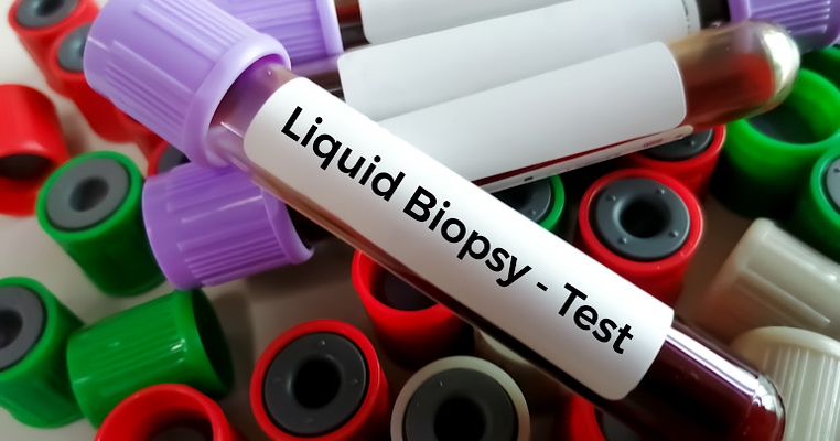 Quest to Reach Another Segment in Liquid Biopsy with New M&A