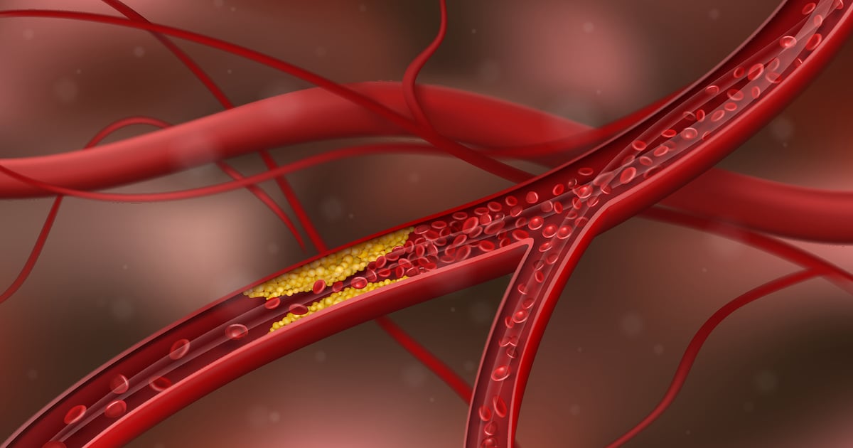 Study using omega-3s, niacin sheds light on mechanisms of action in ...