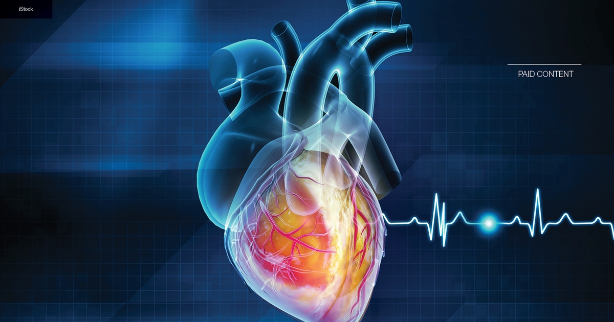 The proactive path to heart health