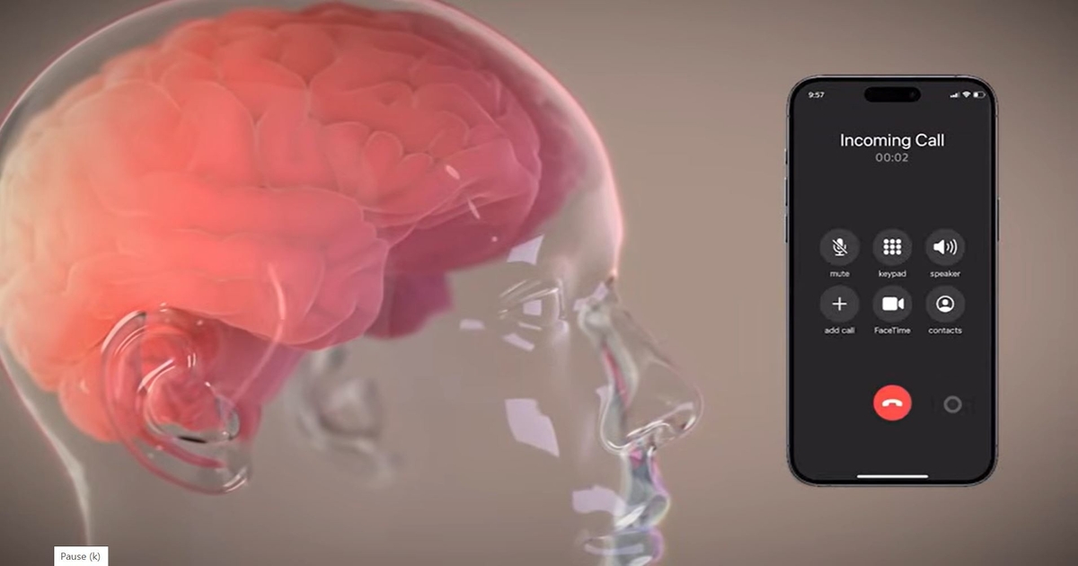 Bluetooth powered Neuralink completes first human implant