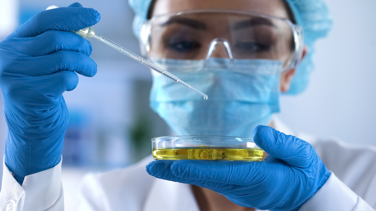 Why your BCR-ABL results don't always add up