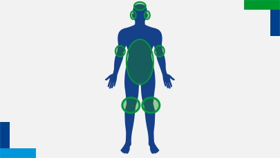 Janssen With Me® Ireland | Psoriasis: Types & Symptoms