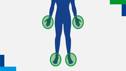 Janssen With Me® Ireland | Psoriasis: Types & Symptoms