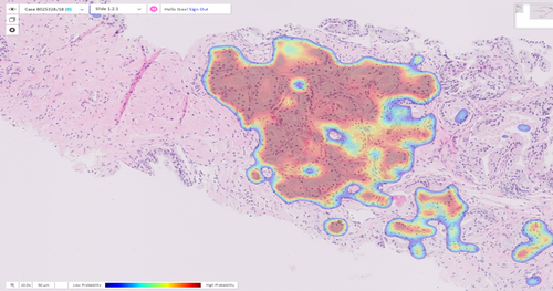 Ibex gets $38 million to further AI-powered cancer diagnostics | AI ...