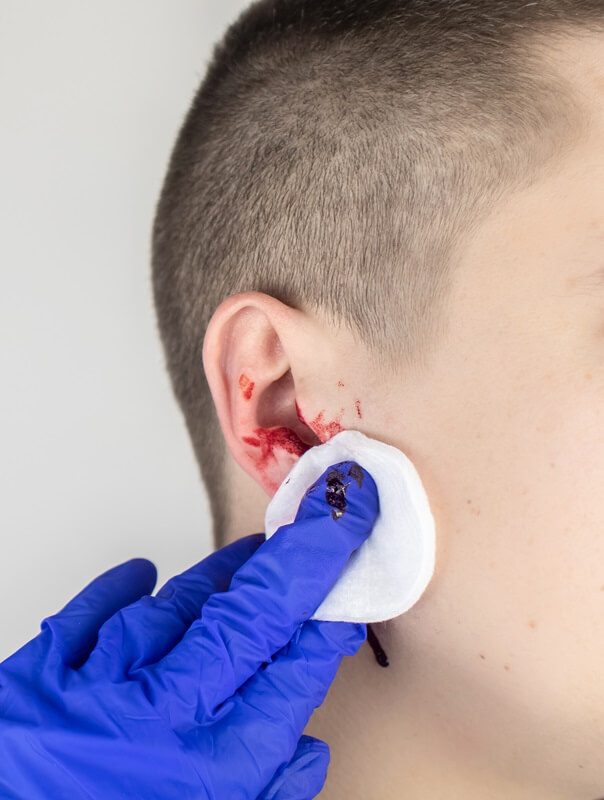 Ear bleeding: causes and treatment