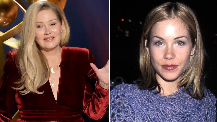 Christina Applegate Plastic Surgery Before And After Photos