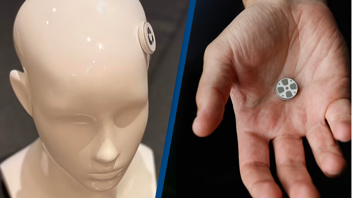 World's first brain implant to treat depression to start second human ... World's first brain implant to treat depression to start second human ...