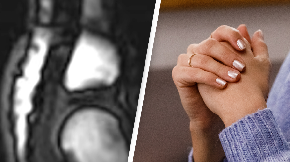 What Happens When You Crack Your Knuckles UT Health Austin | Is