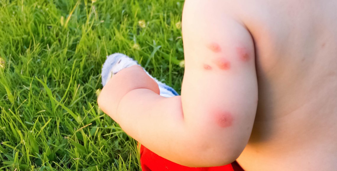 How to Protect Newborn Baby from Mosquito Bites Mortein IN Mortein