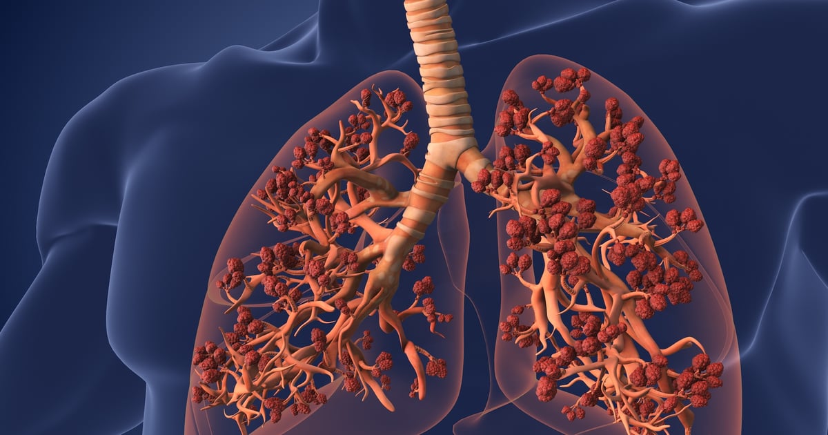 Phillips Medisize Highlights Inhaler Innovations