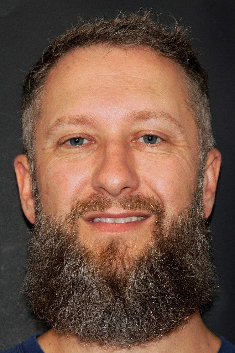 Refillable Packaging: Benefits and Challenges