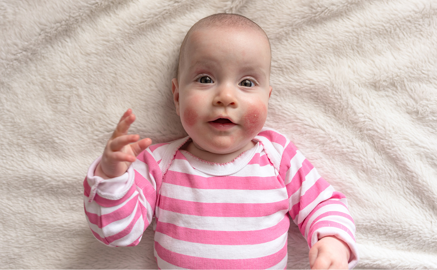 Why Is My Baby's Face Red? | Enfamil