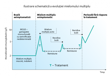 Tipurile de mielom multiplu | Mielomul multiplu | Janssen With Me