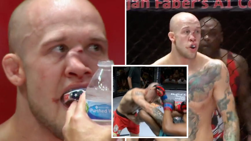 Worst Ufc Broken Nose
