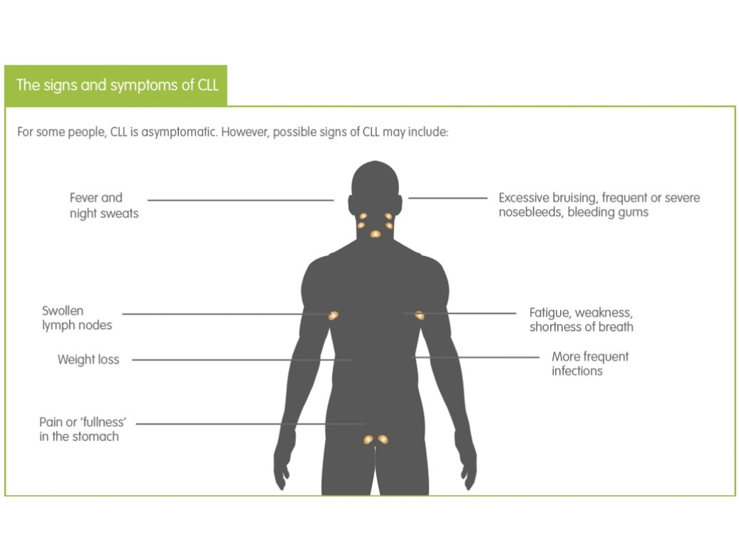Chronic Lymphocytic Leukeamia (CLL) | J&J withMe