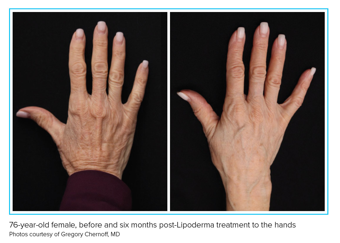 Body Treatments 2026: Skin, Shape & Beyond