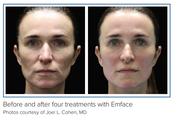 BTL Celebrates 30 Years of Innovation in 2023