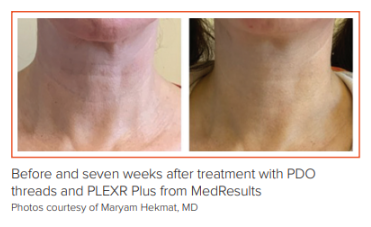 Energy-Based Devices: The Mainstays of Aesthetic Practices