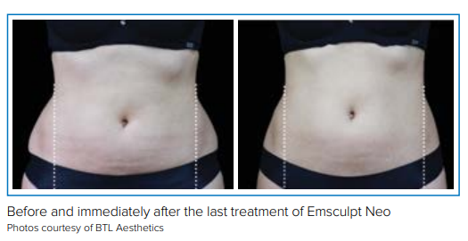 Total Tone Up Merges Muscle Therapies into a One-Hour Powerhouse