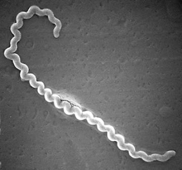 ARS aims to improve diagnostics, vaccine strategies for leptospirosis