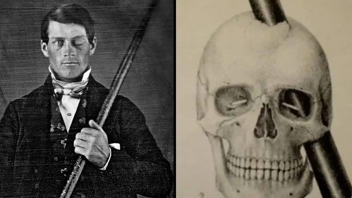 Phineas Gage Costume
