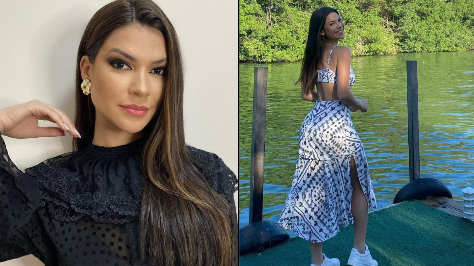 Miss Brazil 2018 Suffers Heart Attack And Dies After Undergoing Routine ...