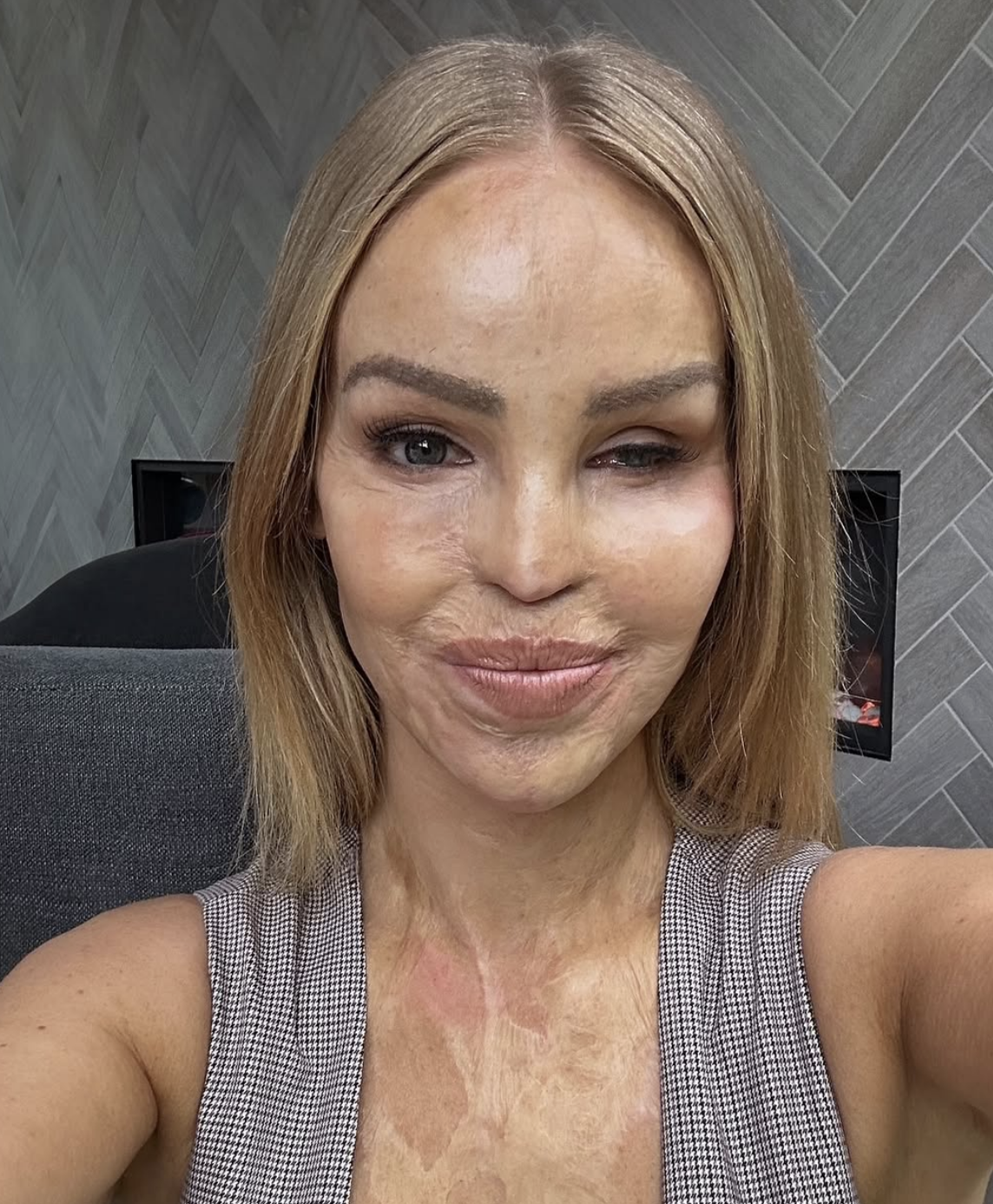 Katie Piper E James Carpenter Loose Women's Katie Piper Says 'staying