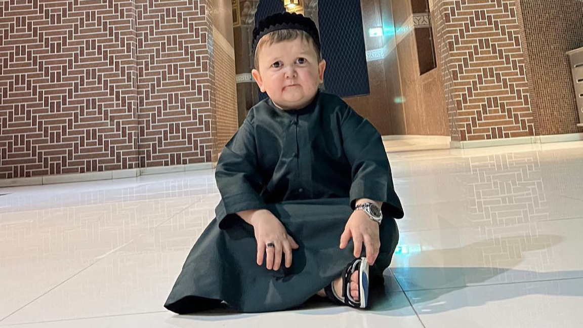 Hasbulla Australian Tour: Everything You Need To Know - TrendRadars