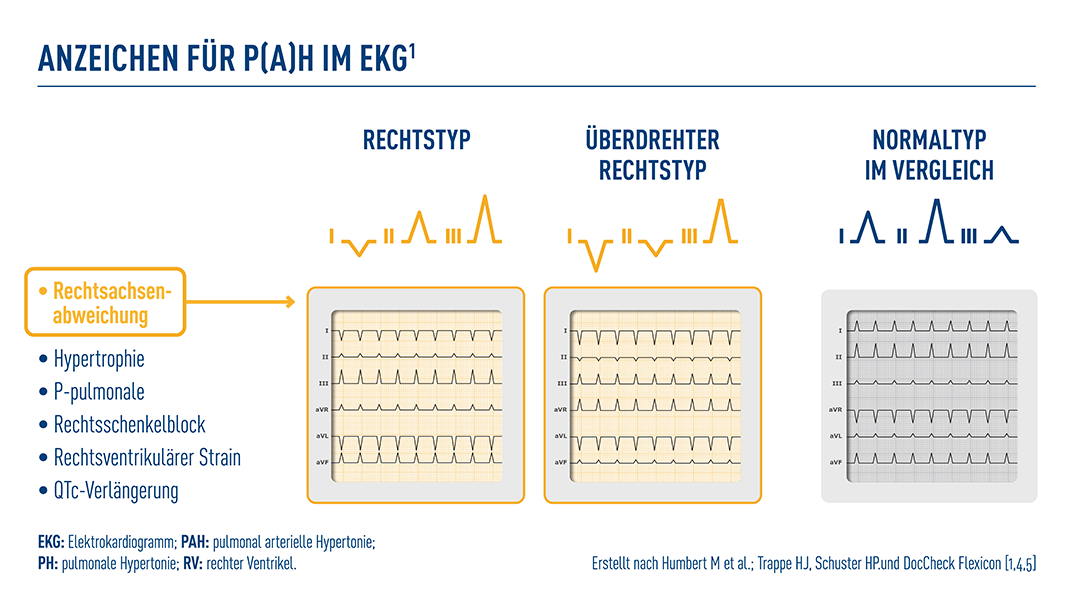 Diagnose der P(A)H | Janssen Medical Cloud
