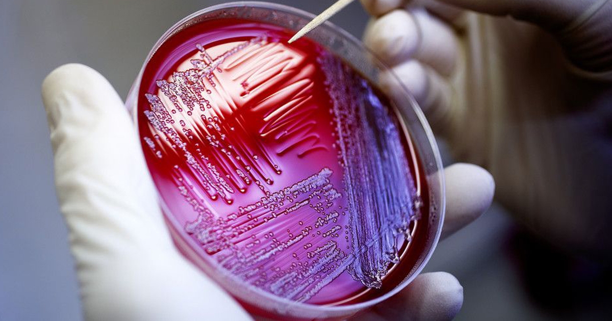 UNL researchers recognized for E. coli work