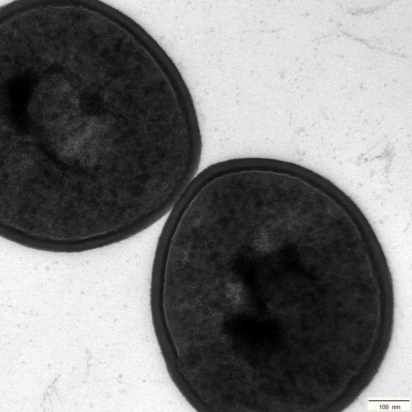 Novel mechanism found for chronic staphylococcal persistence