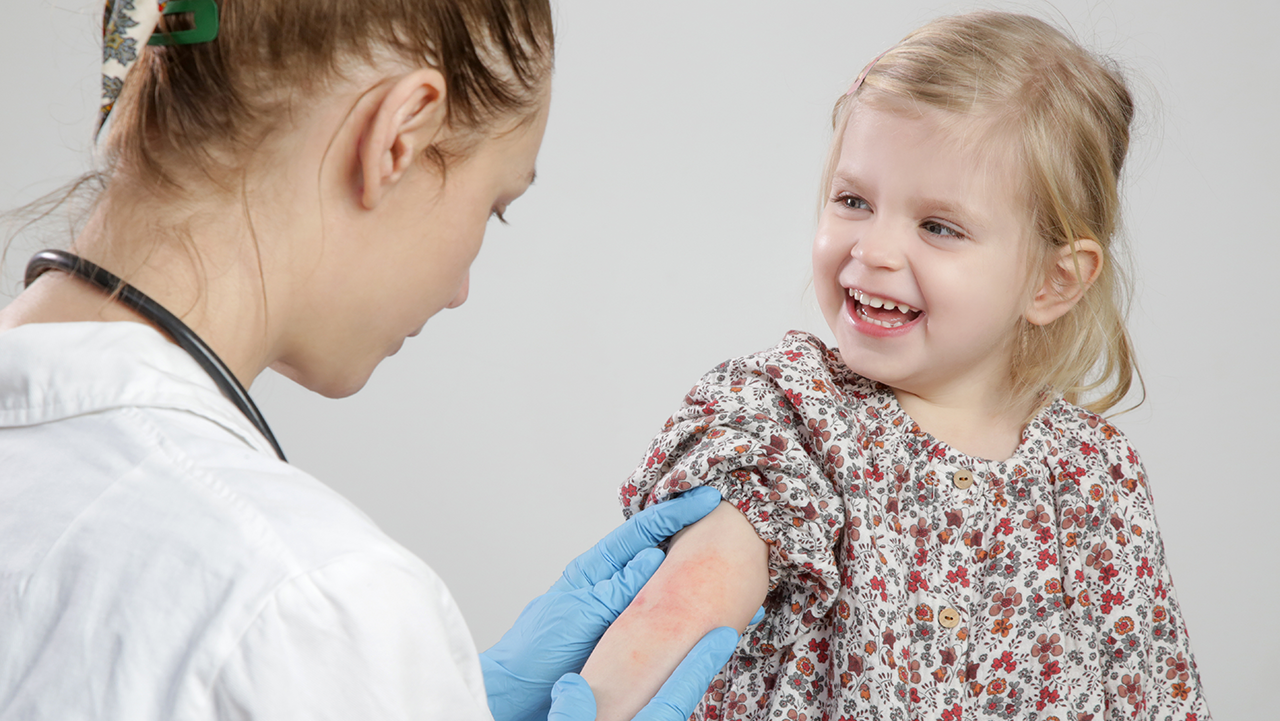 La psoriasi nei bambini e nei neonati come si presenta? | PSORIASI360