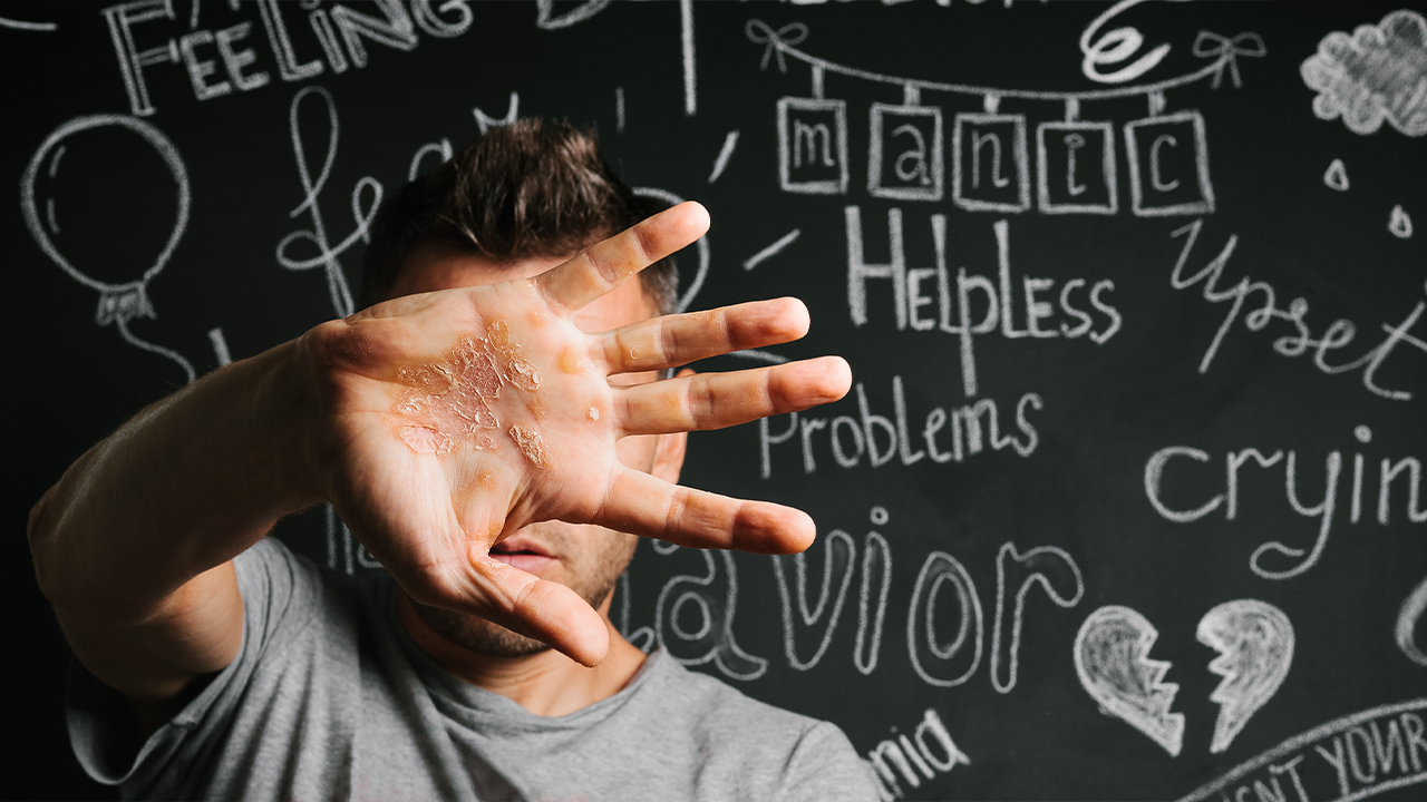 L’impatto della psoriasi in bambini e adolescenti | PSORIASI360